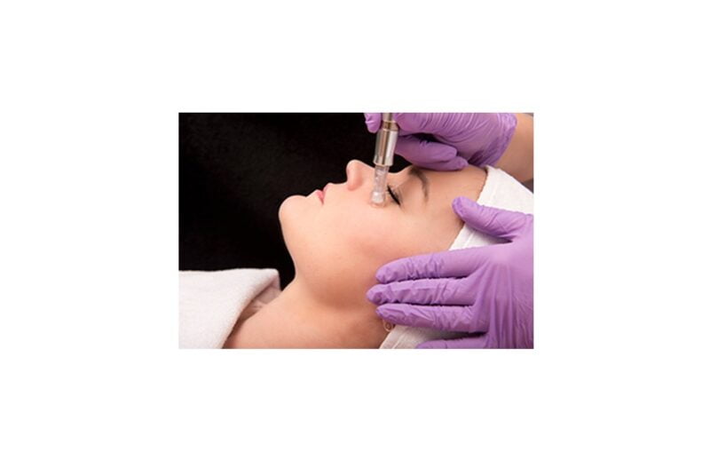 MESO EYE LIFT - Mesoskinline® Mesotherapy Distributor Cyprus